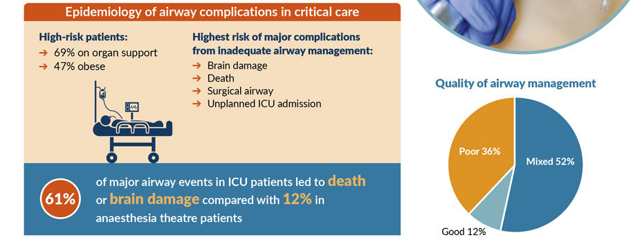 Airway Management in Critical Care